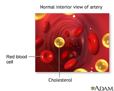 Brain Today: Understanding Cholesterol and Alzheimer's Risk