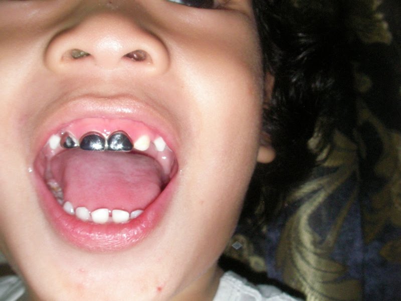 Ace & Amir's Abella CuddleHole: March 2010