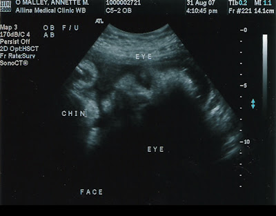 The O'Malleys: Weekly BPP's