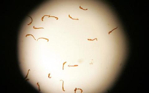 .: Schistosomiasis, Other Worms a Danger to Children: Doctor