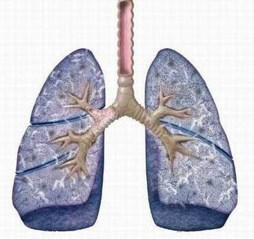 IOvUF: Ironic Lungus