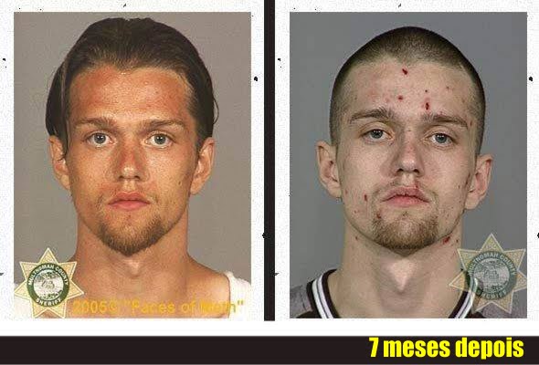 Veja o que a droga faz com a aparência física das pessoas - Brasil ...