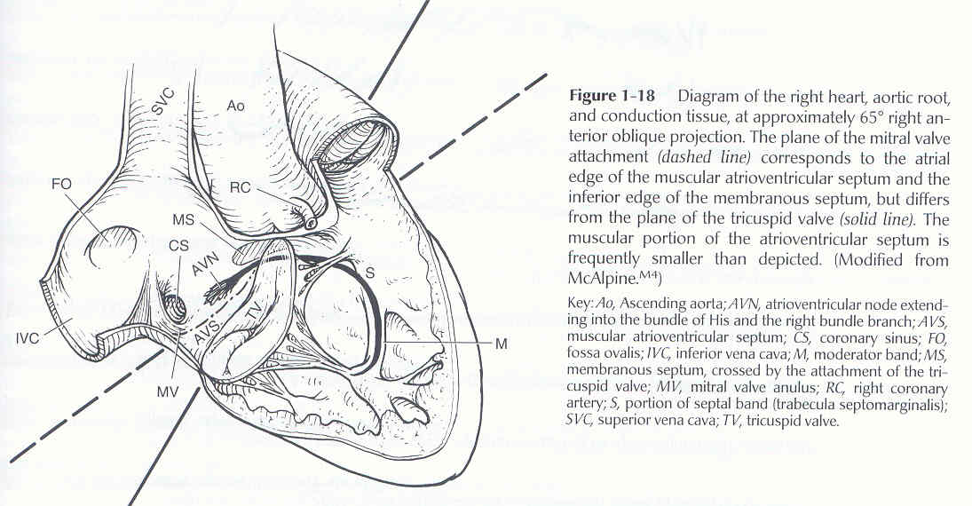 Pedi cardiology: Conduction System - Normal Heart vs. AVSD (One aspect ...