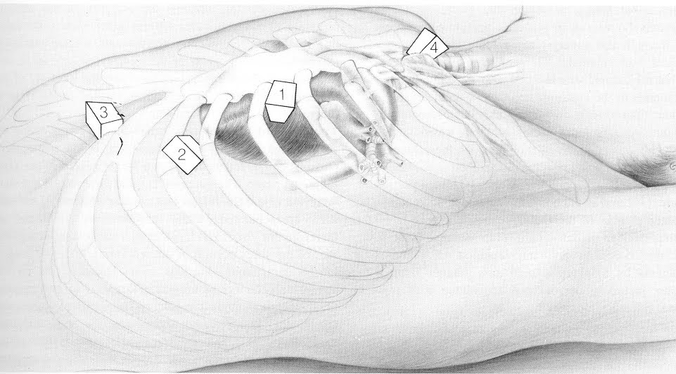 Pedi cardiology: Echo - Basic Views