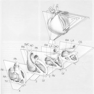 Pedi cardiology: Echo - Basic Views