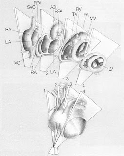 Pedi cardiology: Echo - Basic Views