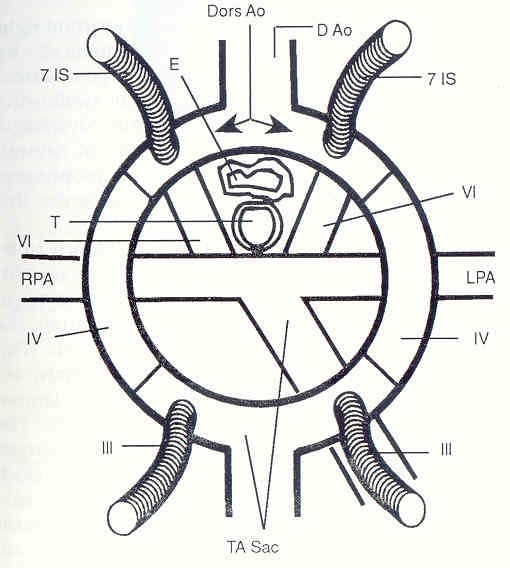 Pedi cardiology: Vascular Ring Analysis using Edwards Hypothetic Aortic ...