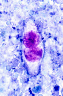 Parasite Heaven: Isospora belli