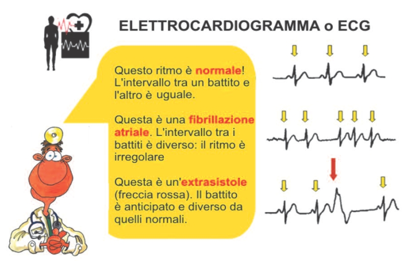 Un Cuore per Amico: Che cosa sono le aritmie?