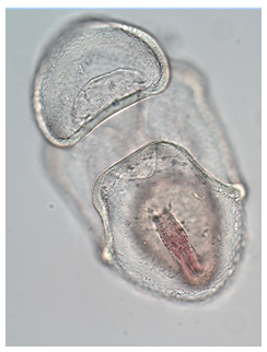 Invertebrate Embryology: Asteroid Bipinnaria Larva
