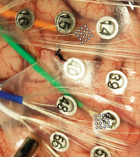 Sinapsis: septiembre 2010