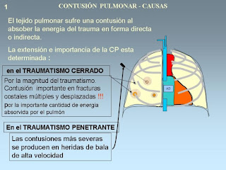 Dra. Altagracia familia Alcántara : Examen del tórax.