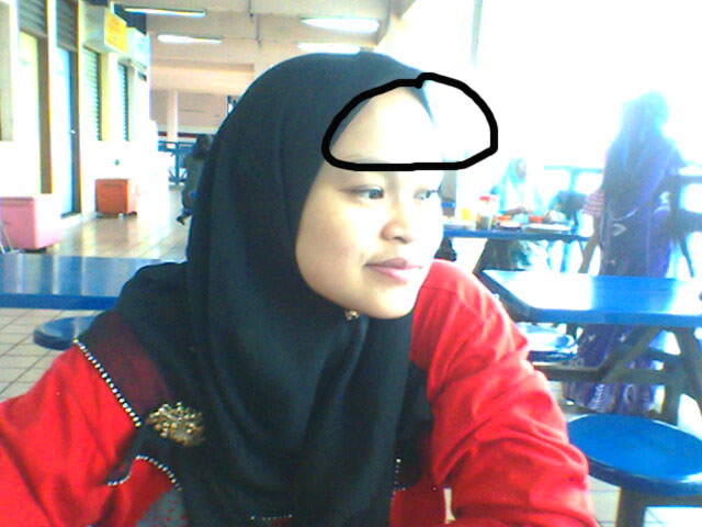 Behind This Black Eyes: jendul, jendol, dahi luas.