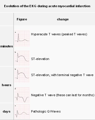 Phimaimedicine: 805. Evolution of EKG in STEMI
