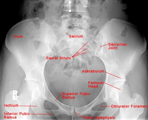 BASIC X-RAY: NORMAL PELVIC ANATOMY