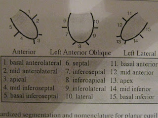 Nuclear Medicine - Another Way Of Learning: GATED BLOOD POOL SCAN ...