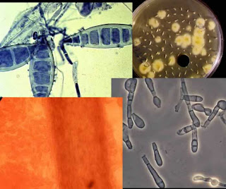 Micologia Biomédica: As Dermatofitoses e seus causadores: Microsporum ...