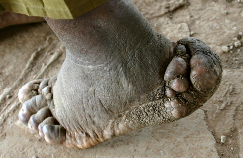 oXygen: ..who really lives that way?