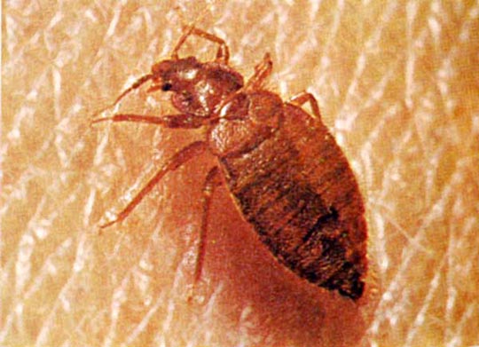 Hanya Info Saja: Kutu yang hidup dan bersemayam pada tubuh manusia!!!