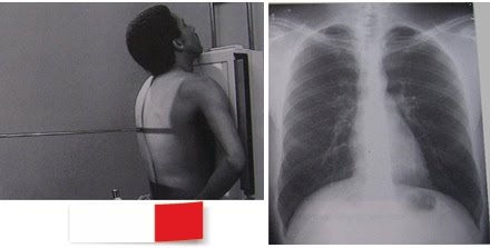 Rayos 2011: Tórax - Proyecciones