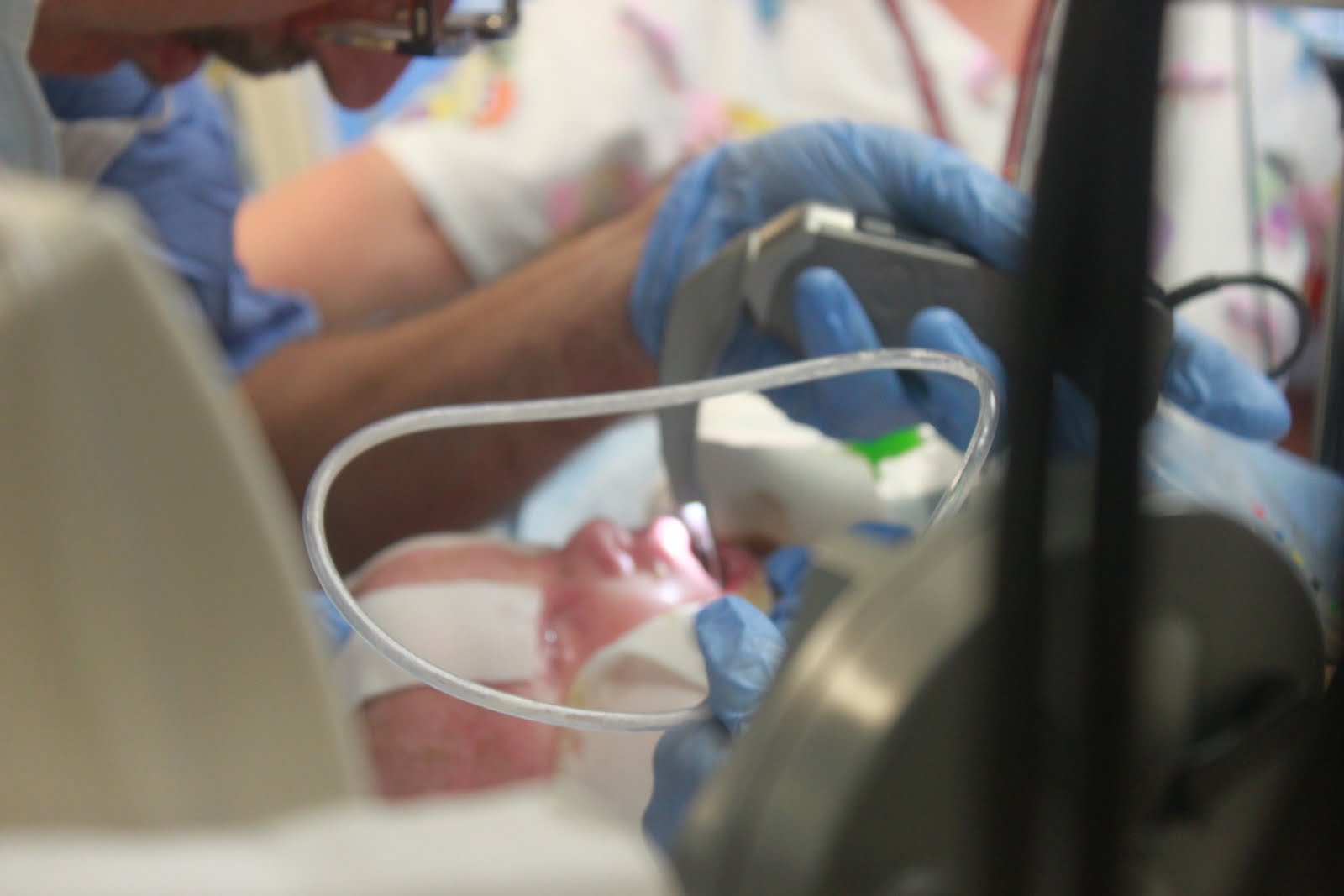 Baby Daylon: Day +46: EXTUBATION DAY!!