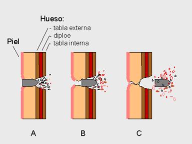 Introduccion a la Balistica