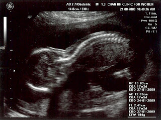 The Bub in the Belly: Scan at 17 weeks - Gender announcement and ...