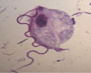 trichomonas