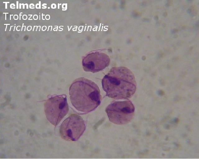 trichomonas