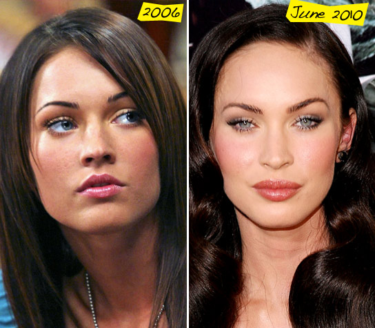 PASSIONE DA VIDA: BOTOX AND FILLERS GONE BAD - MEGAN FOX