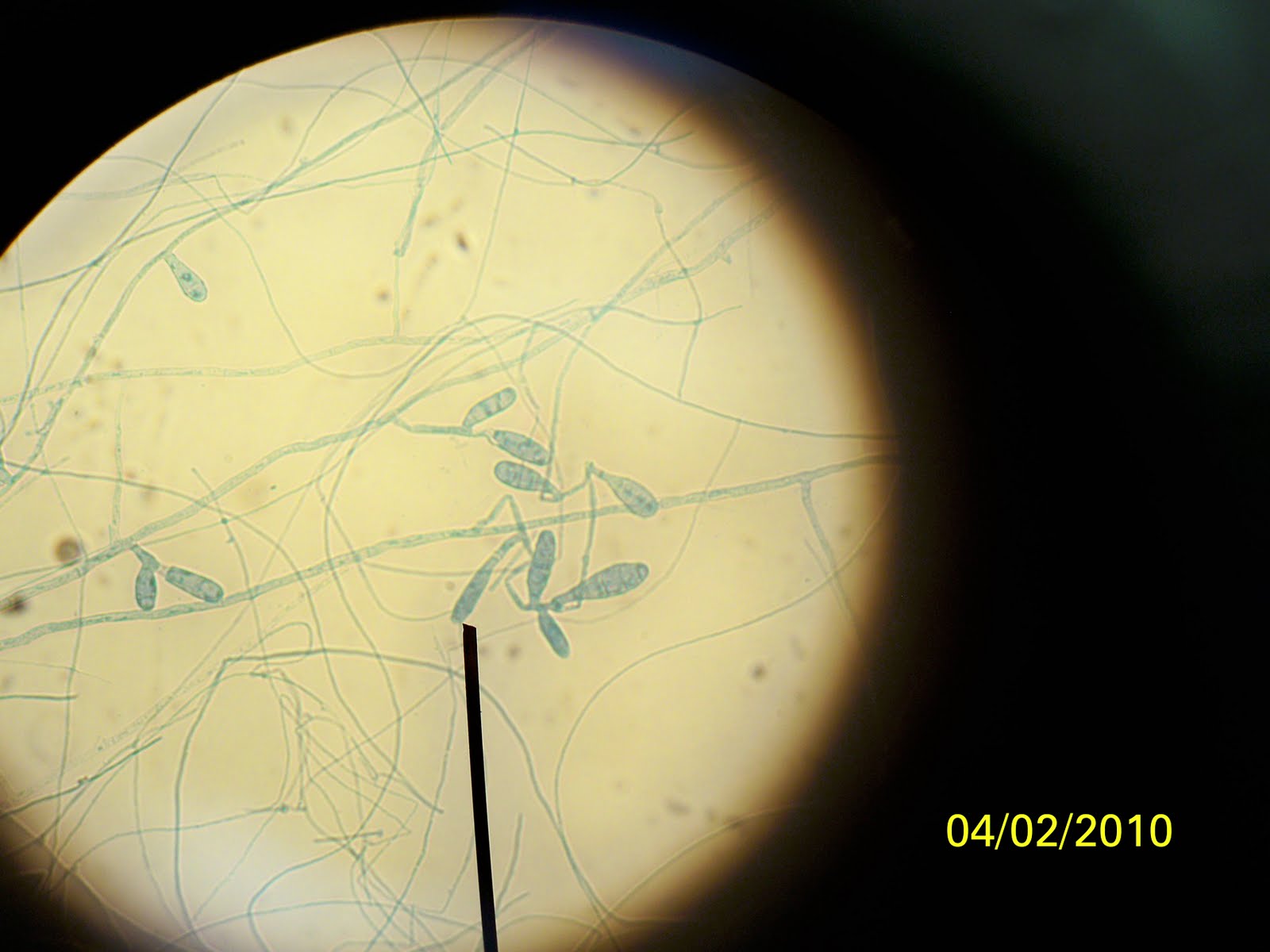 Microbiology: Techniques, Sapprophyte