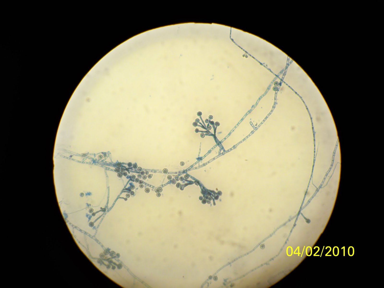 Microbiology: Techniques, Sapprophyte