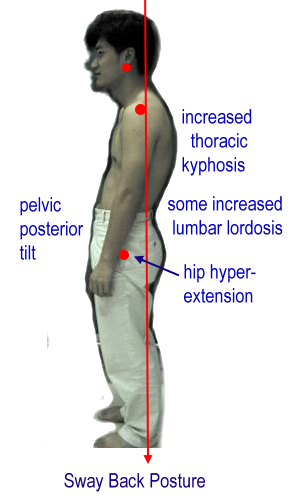 El proceso: Sway Back