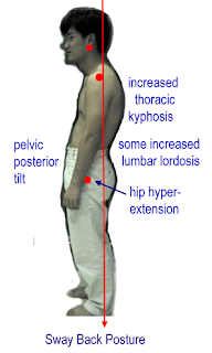 El proceso: Sway Back