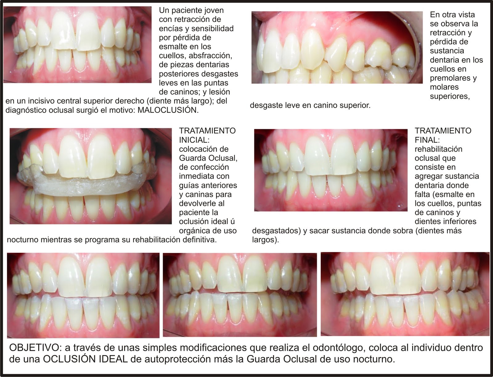 A SU SALUD: OCLUSIÓN REAL