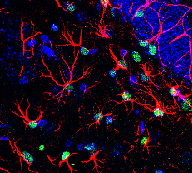 herenciageneticayenfermedad: Bmpr1a regula la quiescencia de las ...