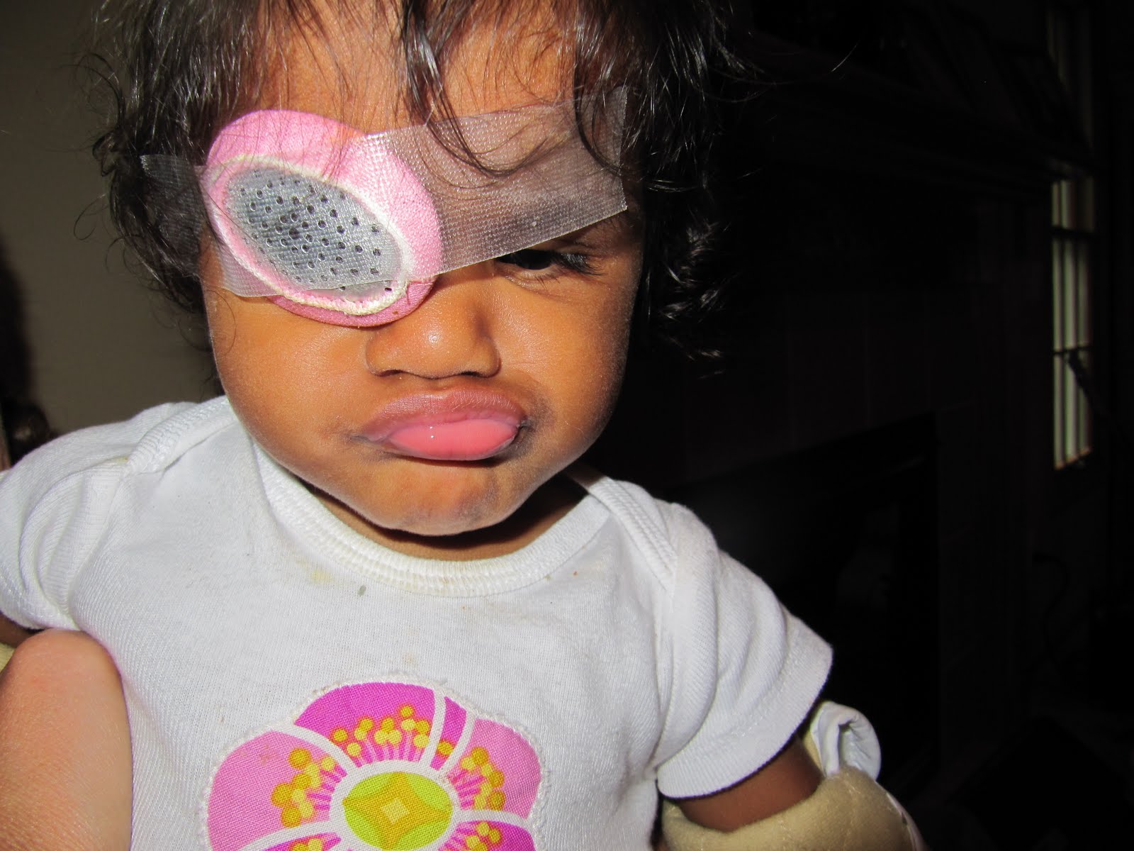 The VanderKooi's Vida: Update on Afeefa's Latest Surgery