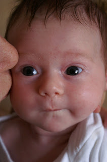 Summer Hope Rudd: Exomphalos shrinking....
