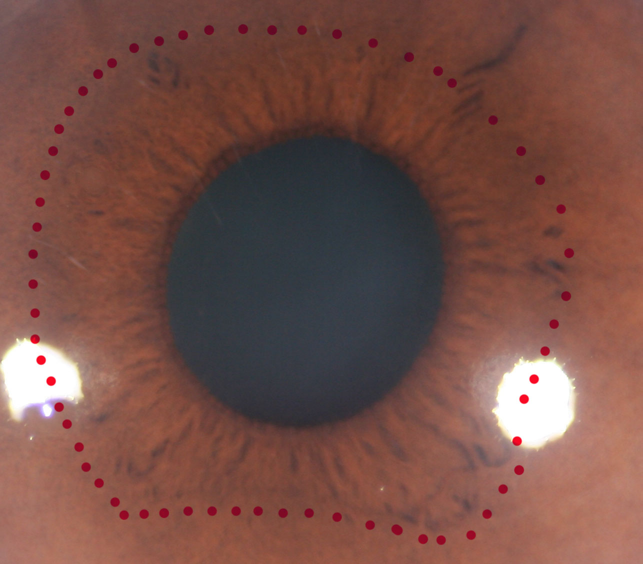 Modern & Multidimensional Iridology: Iridology + Sclerology Analysis