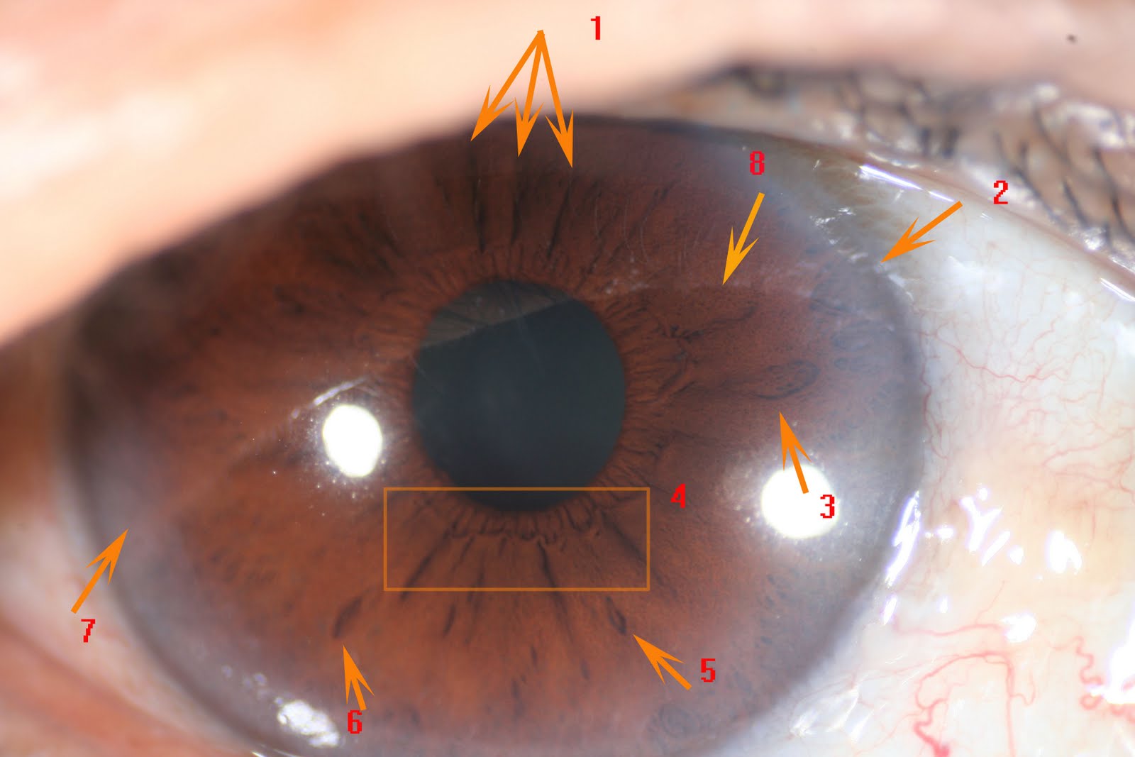 Modern & Multidimensional Iridology: Iridology Analysis - 42