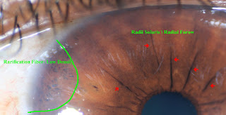 Modern & Multidimensional Iridology: iris- 4