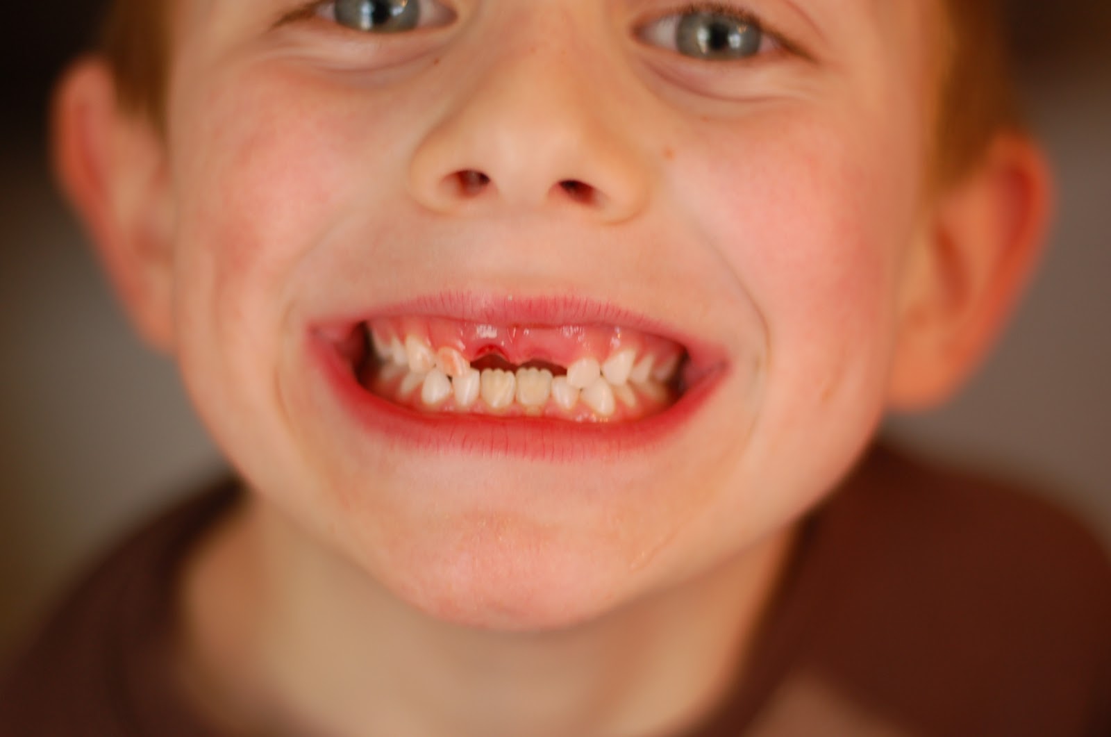 Life to LIFE: February 2011