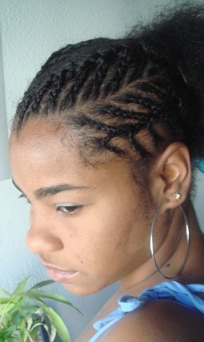 Keep It Kinky: Natural Hair and Beauty: No Flakes Here – How to Treat ...