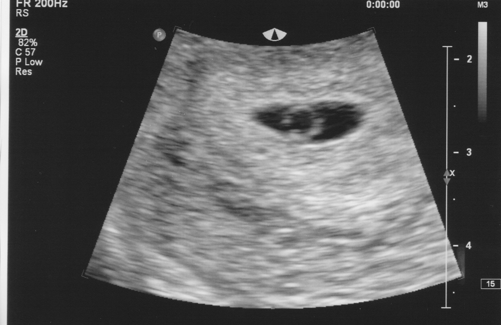 New Baby new-baby