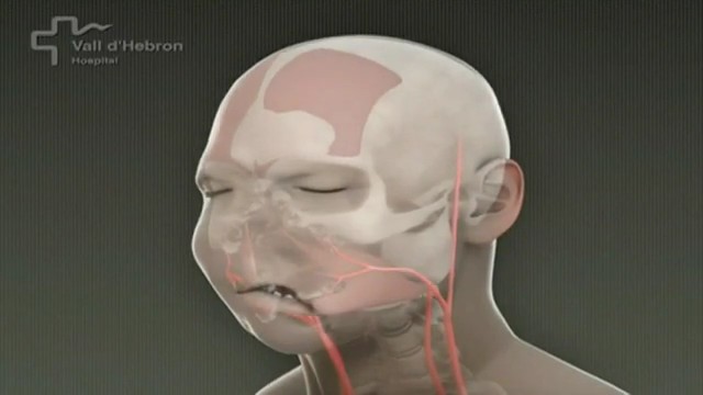 doctors videos backup: World's first full face transplant carried out