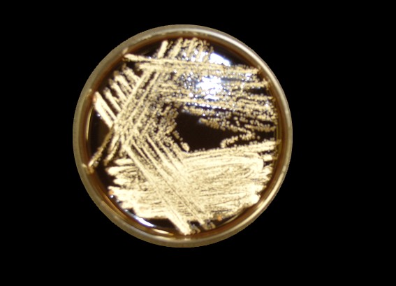 Fun With Microbiology (What's Buggin' You?): Nocardia species