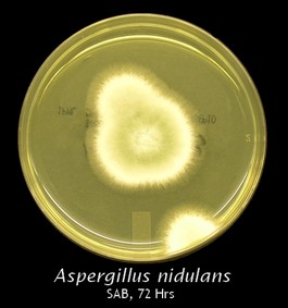 Fun With Microbiology (What's Buggin' You?): Aspergillus nidulans ...