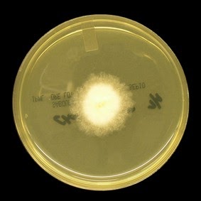 Fun With Microbiology (What's Buggin' You?): Chaetomium Species