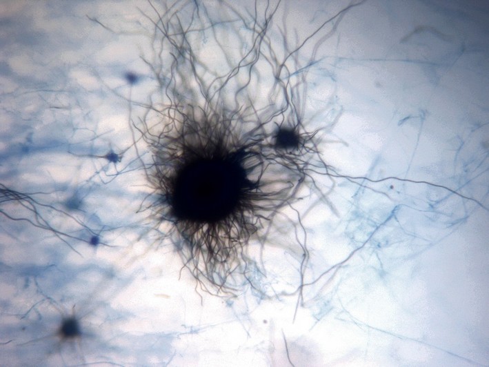 Fun With Microbiology (What's Buggin' You?): Chaetomium Species