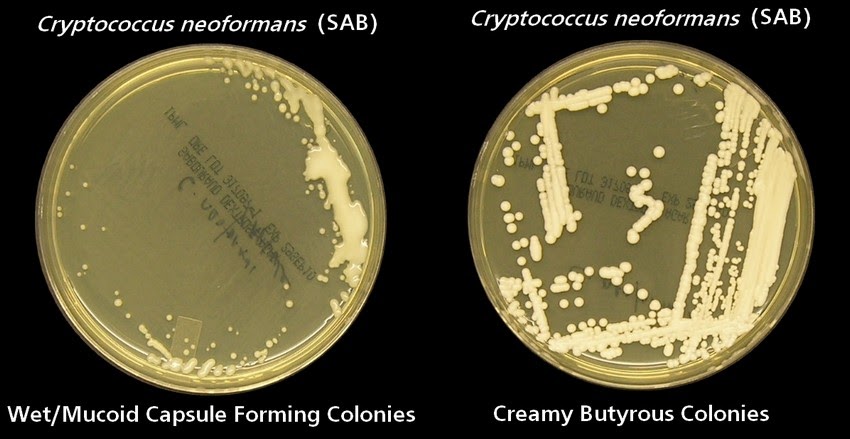 Fun With Microbiology (What's Buggin' You?): Cryptococcus neoformans